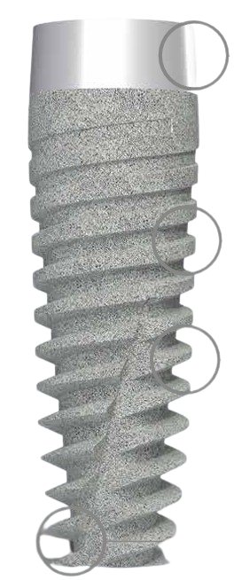 FMD Kreo Dental Implant | SpotImplant