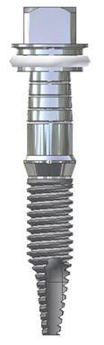 Serson Implant Ex Conico Dental Implant | SpotImplant