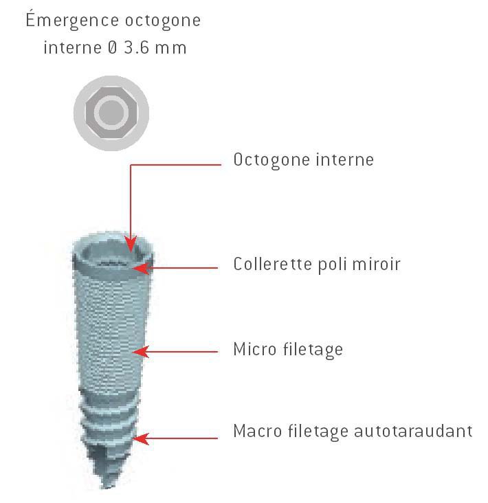 Victory Fratex Internal Octagon (OFX) Implante dental | SpotImplant